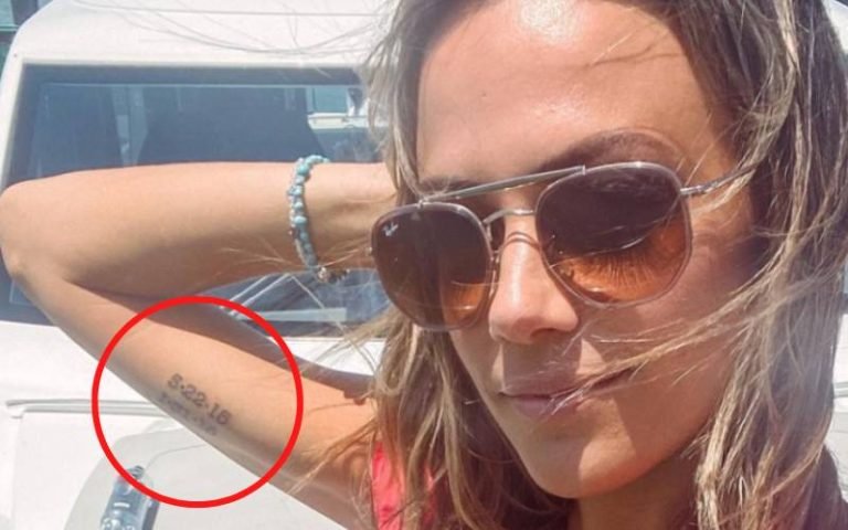 44 Famous Celebrity Tattoo Removal Before and After Looks! - Tattoo Twist